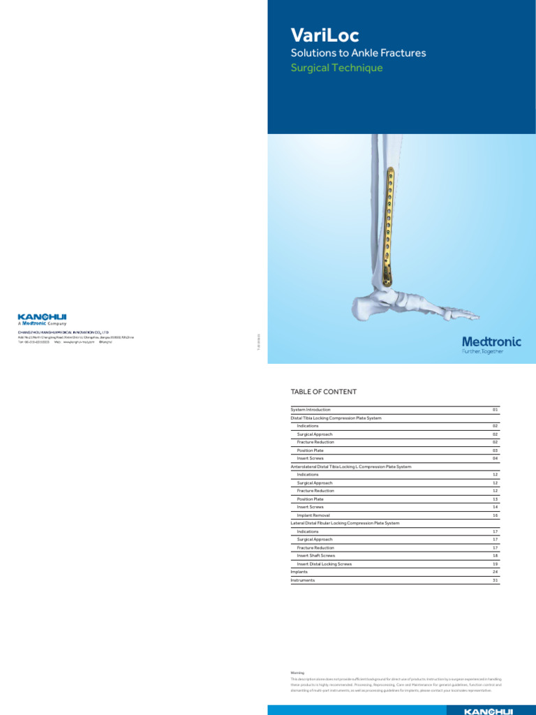 VariLoc Distal Tibia Plate Overview | PDF | Drill | Screw