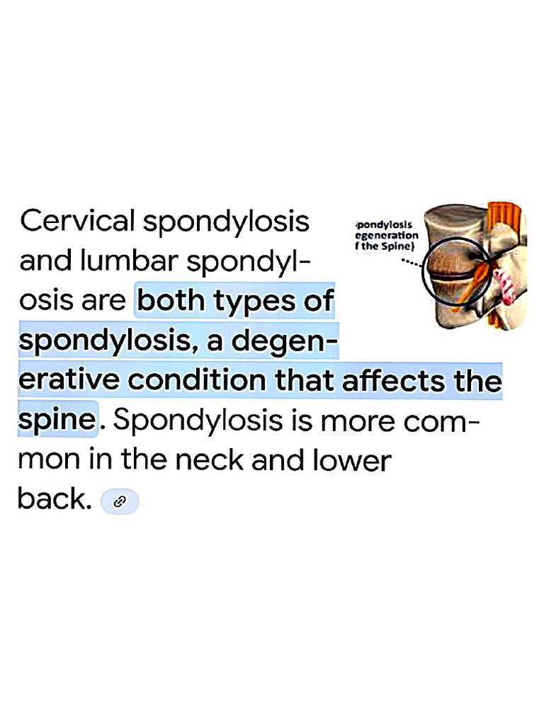 Cervical and Lumbar Spondylosis | PDF