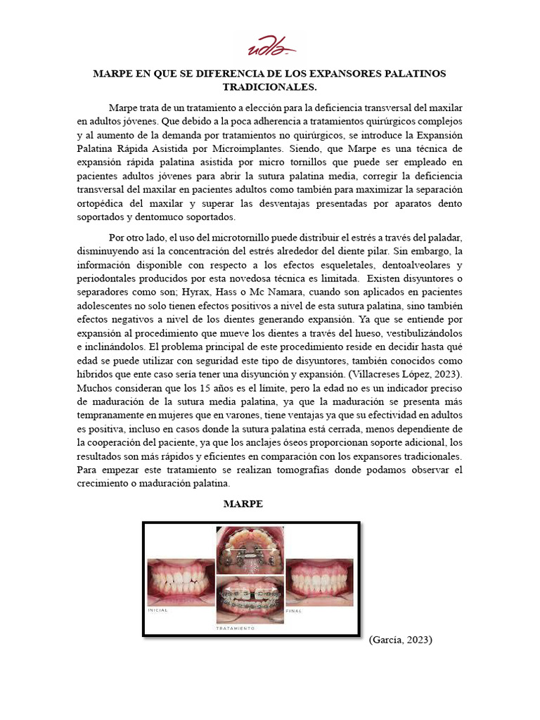 Diferencias entre MARPE y expansores tradicionales | PDF ...