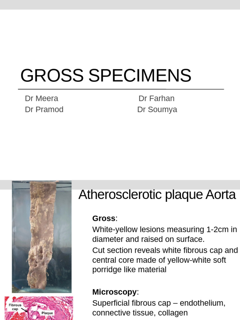 Gross Specimens Revision | PDF | Liver | Necrosis