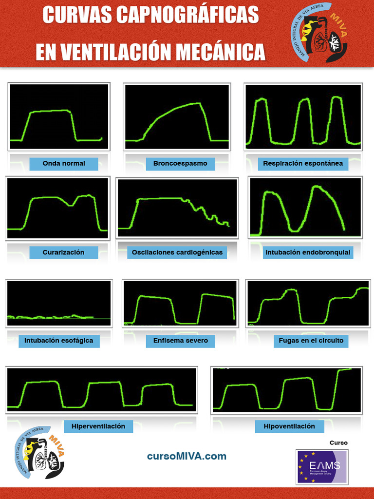 Curvas Capnográficas en Ventilación | PDF