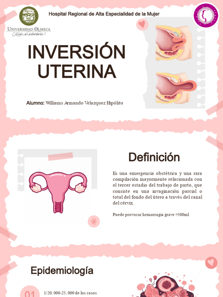 Z Inversion Uterina | PDF | Útero | Salud maternal