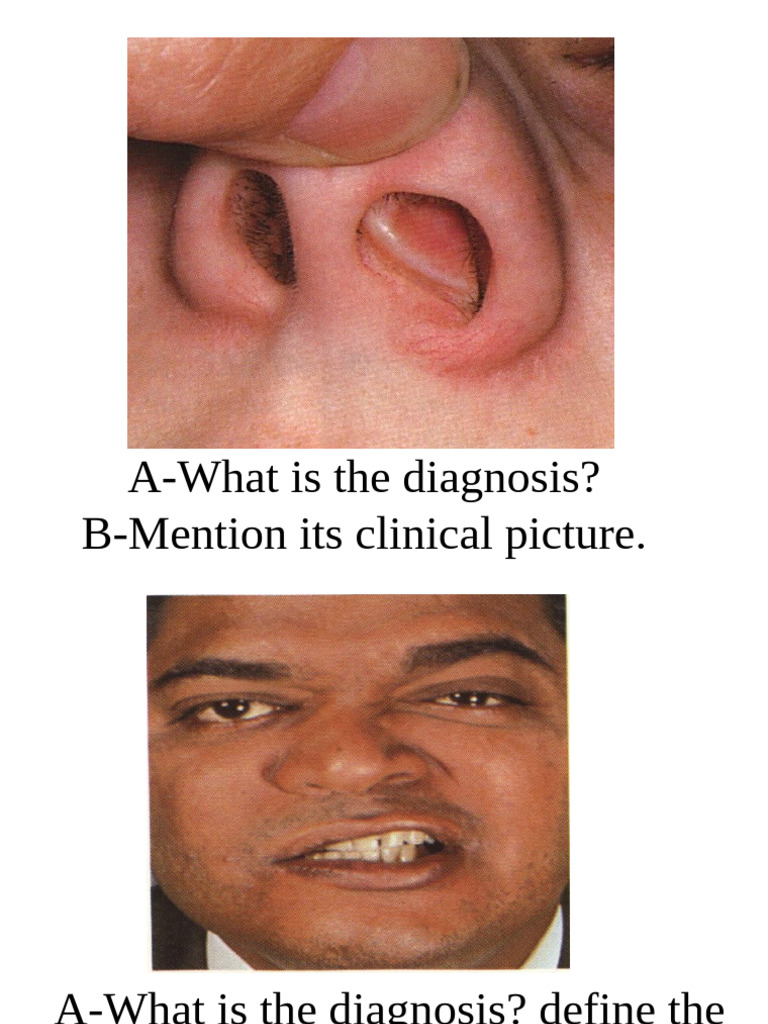 Diagnosis and Treatment of Hearing Loss | PDF