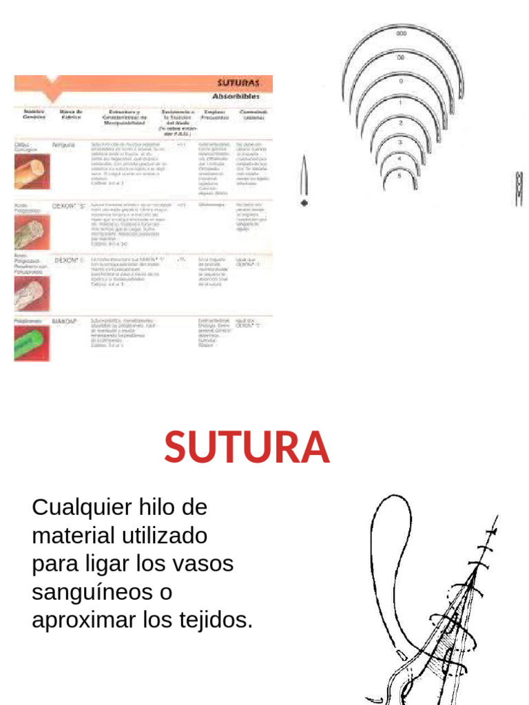 Suturas y Agujas | PDF | Sutura Quirúrgica | Seda