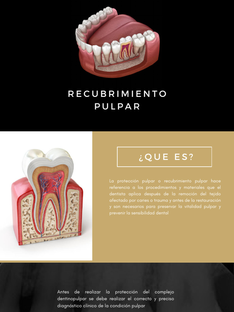 Recubrimiento Pulpar | PDF | Especialidades Medicas | Medicina CLINICA