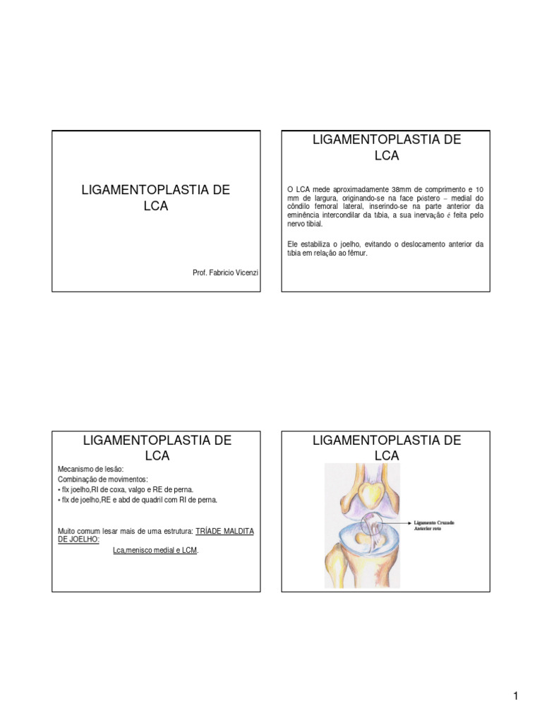 2016221_223152_ligamentoplastia de Lca 2 | PDF | Joelho | Anatomia humana