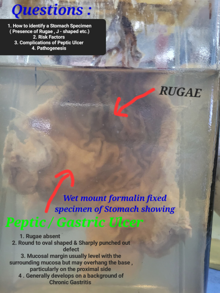 Pathology Specimen 2021 Batch | PDF