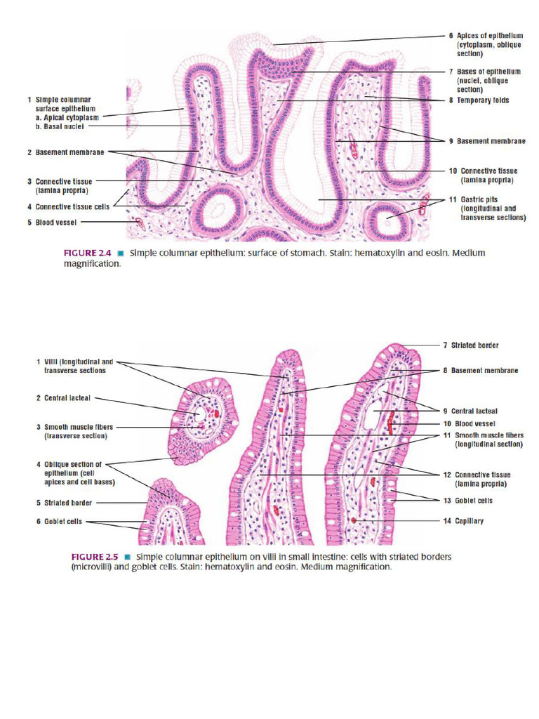 Histo Diagrams | PDF