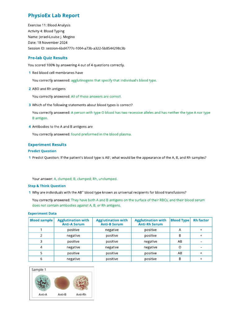 MEGINO - Exercise 11 Activity 4 Blood Typing | PDF