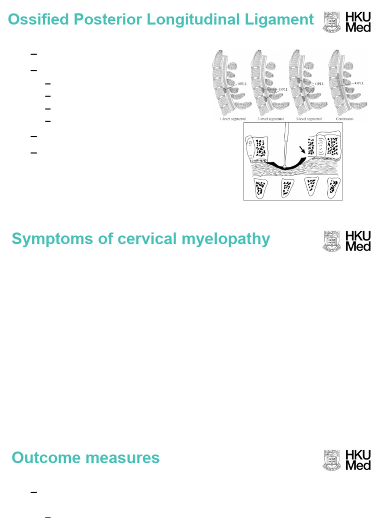 Ossified Posterior Longitudinal Ligament Overview | PDF