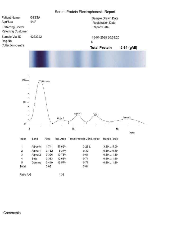 Hplc graph | PDF