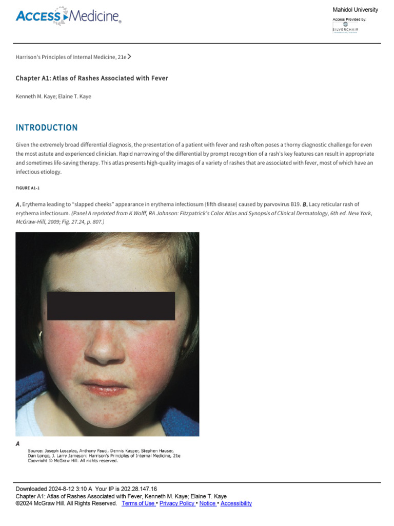 Chapter A1 - Atlas of Rashes Associated With Fever | PDF | Animal ...