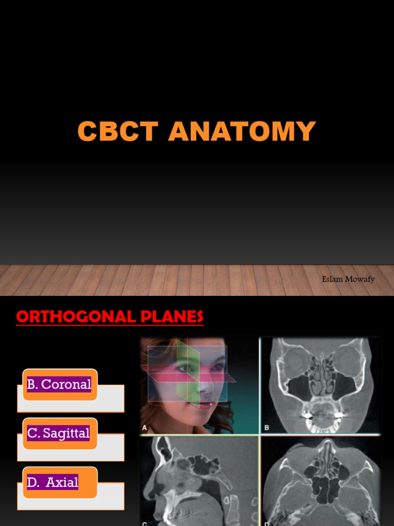 CBCT Anatomy Overview and Planes | PDF