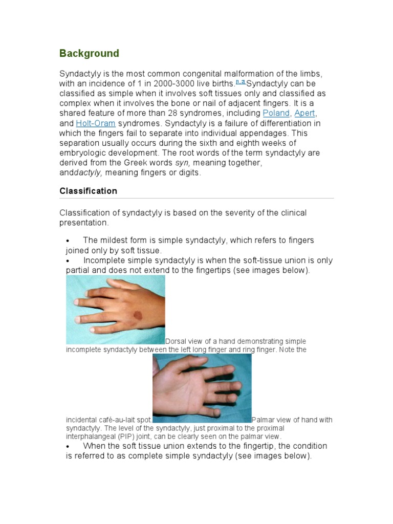 Background: Poland Apert Holt-Oram | PDF | Finger | Hand