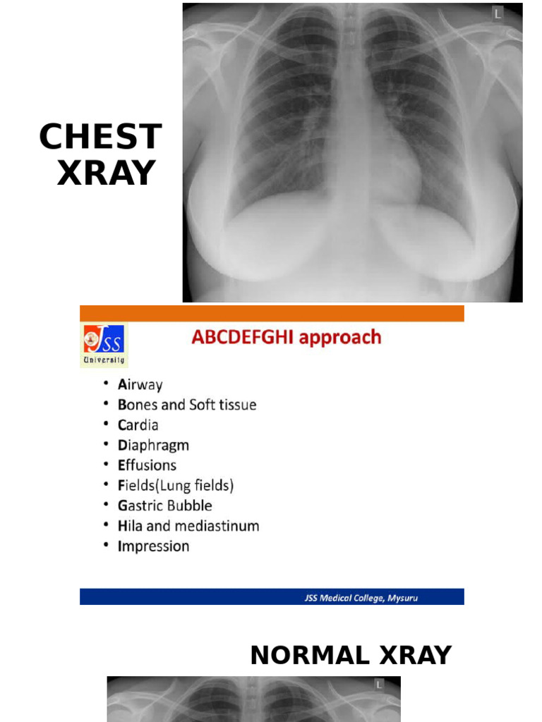 Chest X-Ray Findings and Conditions | PDF