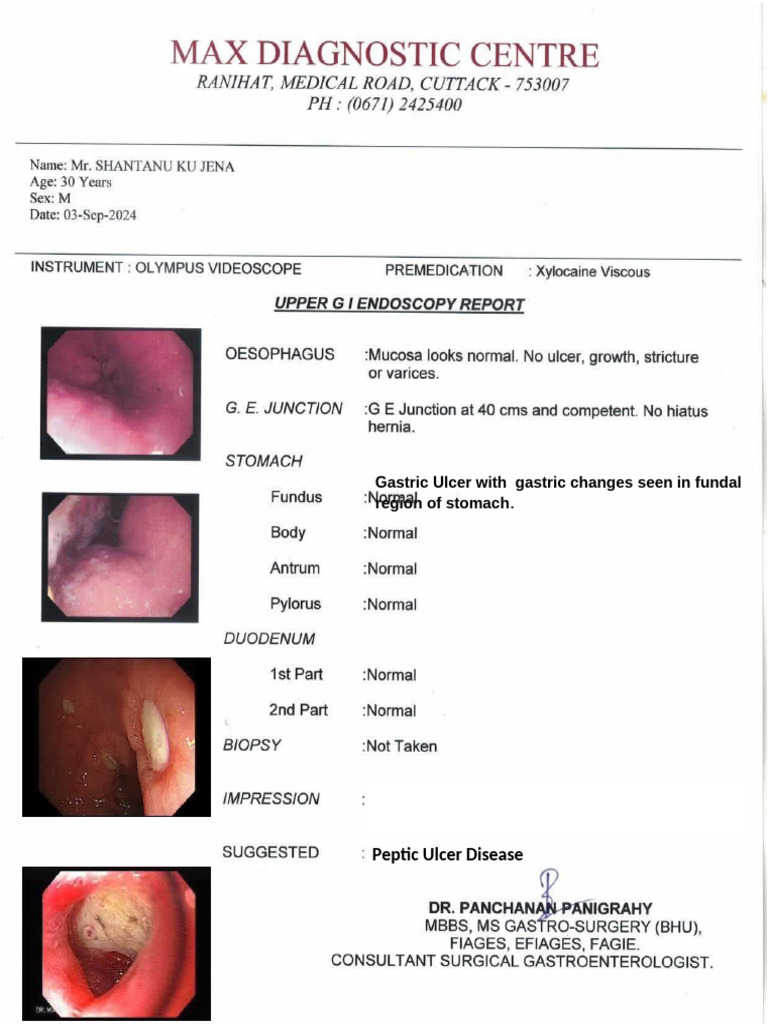 Fundal Gastric Ulcer Overview | PDF