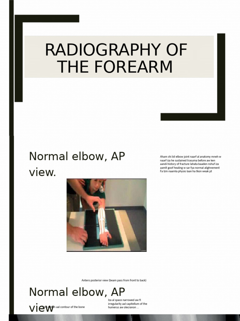 Forearm Trauma and X-Ray Positioning | PDF | Elbow | Thumb