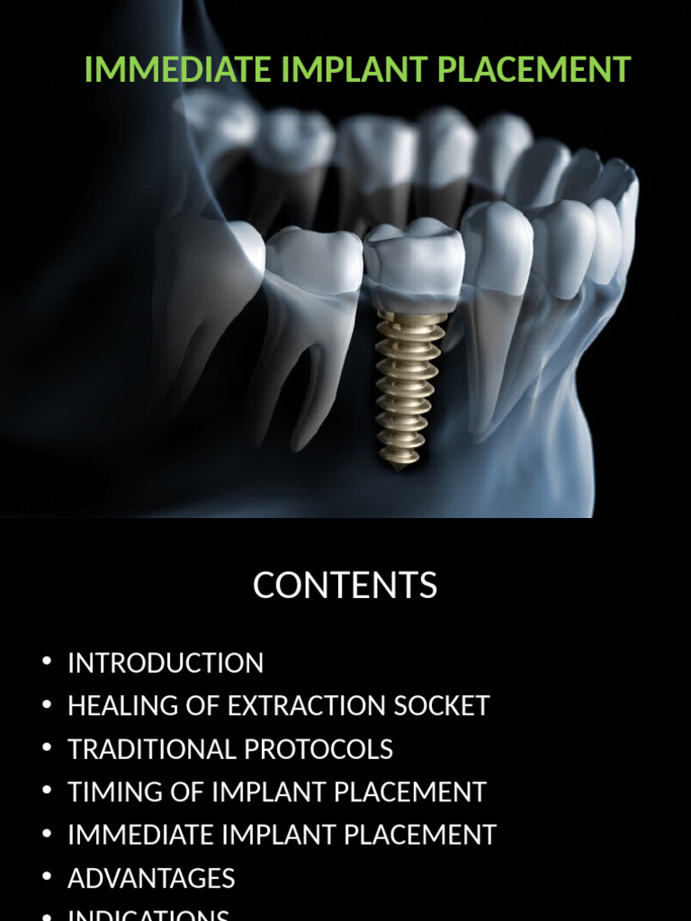 Immediate Implant Placement | PDF | Dental Implant | Human Tooth