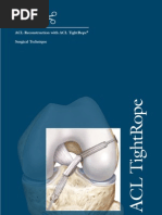 Acl Tightrope Attachable Button System | PDF | Musculoskeletal System ...