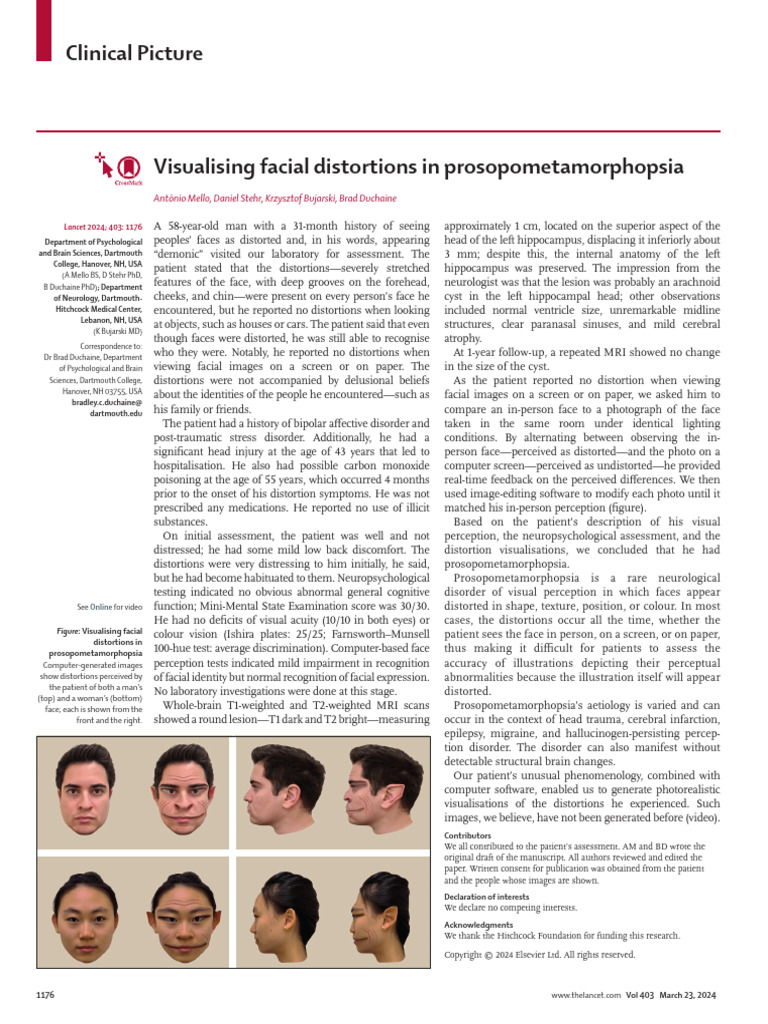Visualising Facial Distortions in Prosopometamorph | PDF | Neurology ...