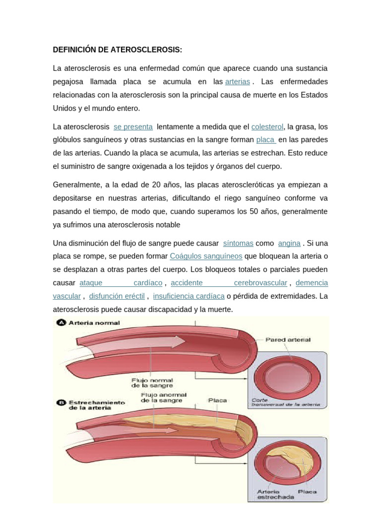 Aterosclerosis: Causas, Síntomas y Riesgos | PDF | Aterosclerosis ...