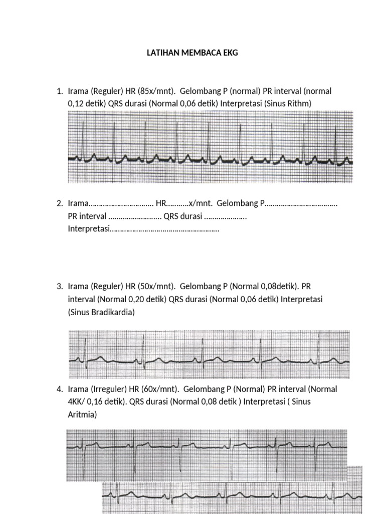 EKG (R. Roro Maria Ulfah - SHSB) | PDF