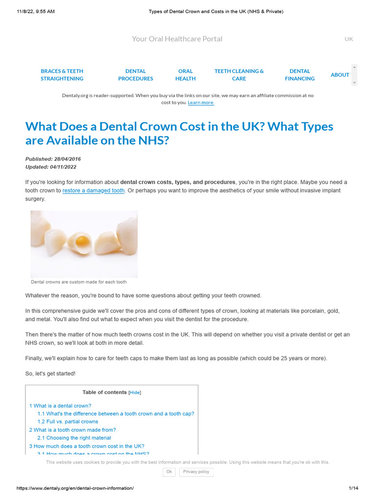 Types of Dental Crown and Costs in The UK (NHS & Private) | PDF | Dentistry | Dental Implant