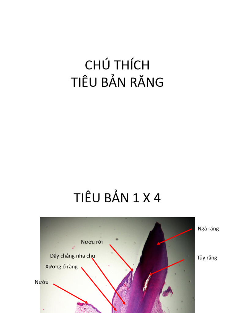 Mo Rang Thuc Tap 1 1 | PDF