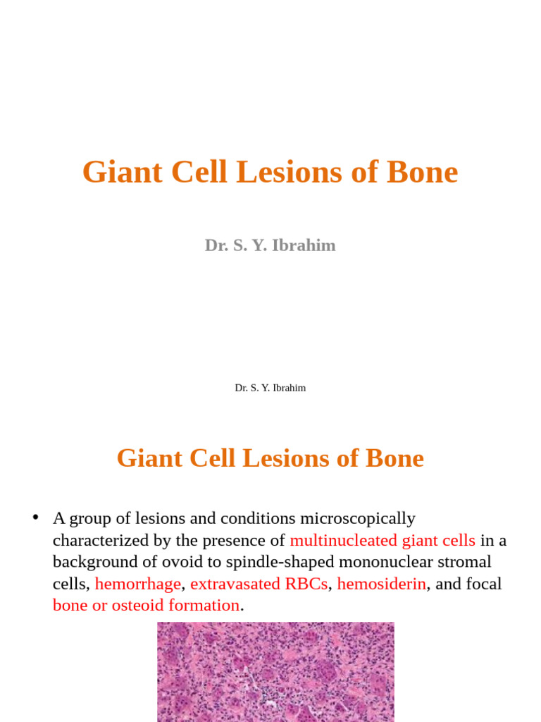 Giant Cell Lesions of Bone Overview | PDF | Diseases And Disorders ...