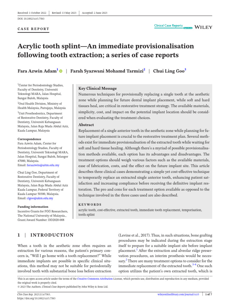 Acrylic_tooth_splint-An_immediate_provisionalisati | PDF | Dental ...