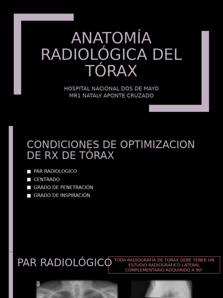 Anatomía Radiológica Del Tórax | PDF | Tórax | Aorta