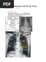 RX Tórax Normal y Patològica | PDF | Pulmón | Tórax