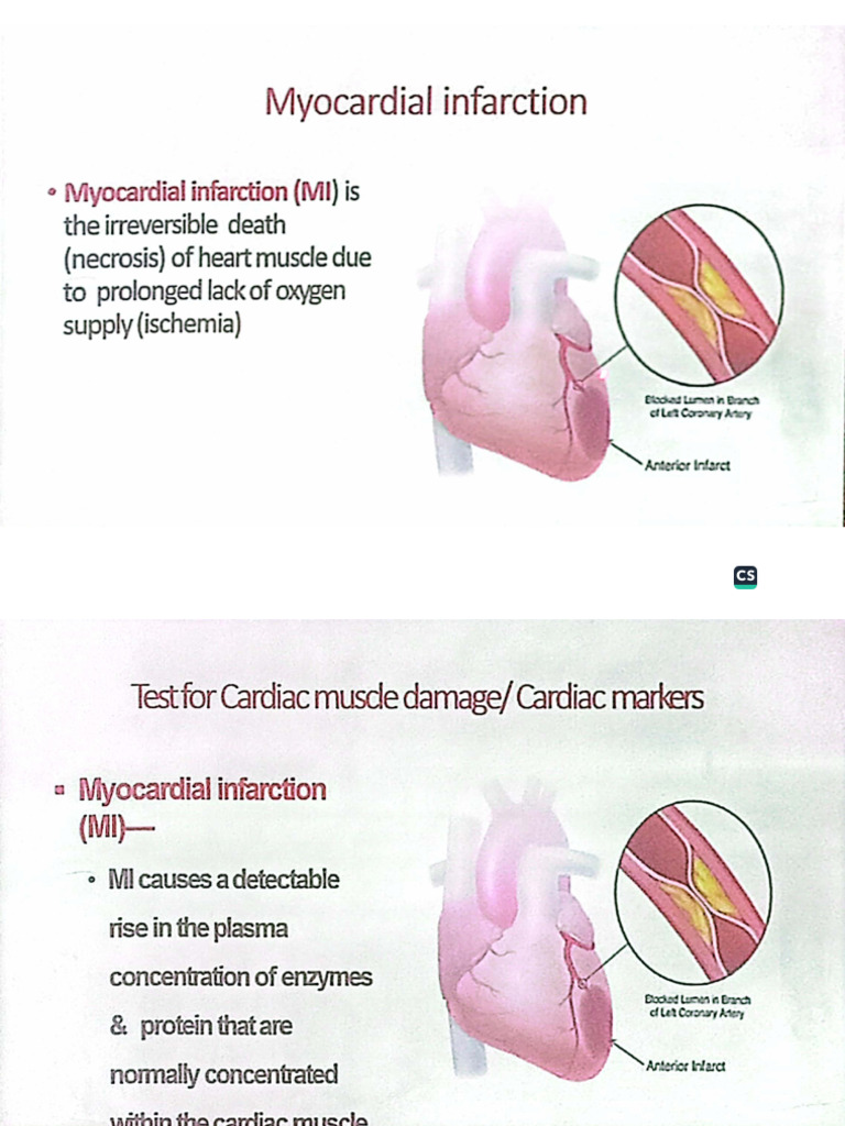 Cardiac Marker | PDF