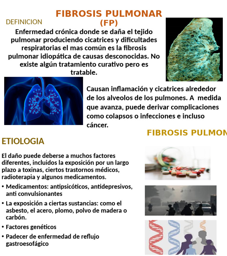 Fibrosis Pulmonar: Causas y Tratamiento | PDF