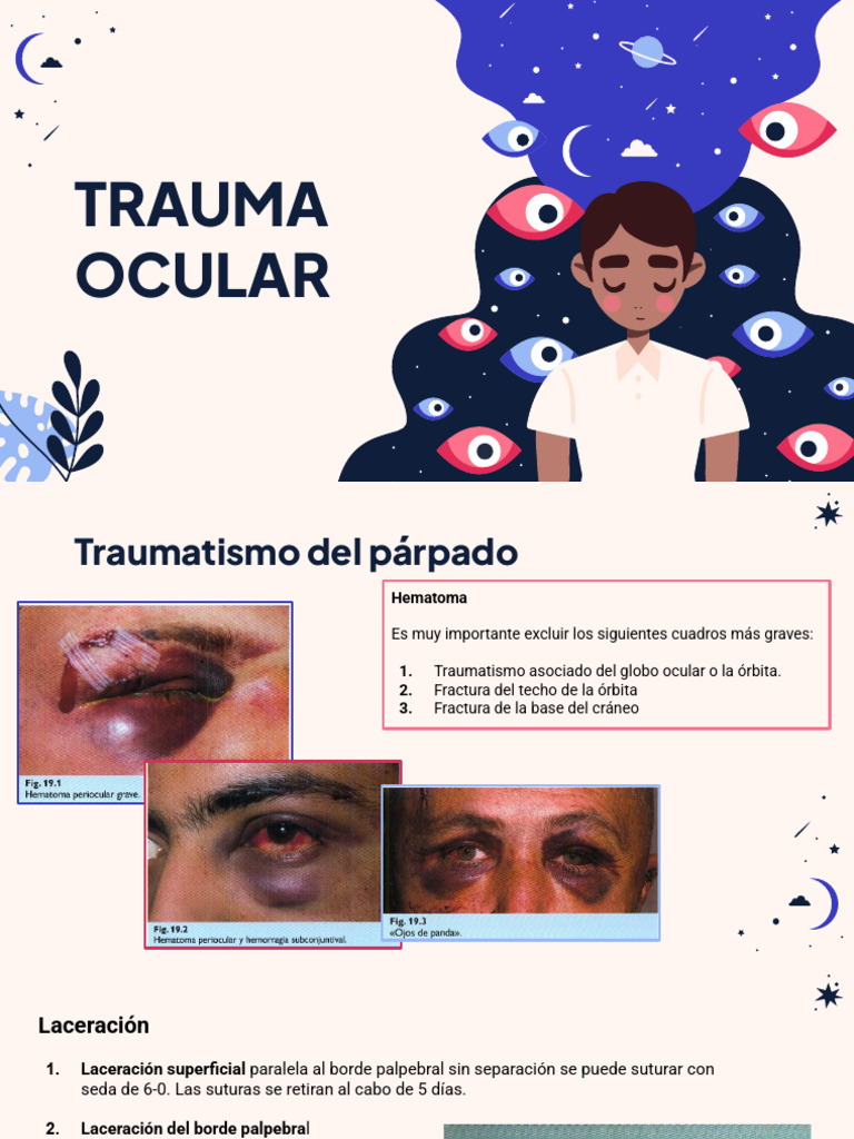 Trauma Oc | PDF | Córnea | Ojo humano