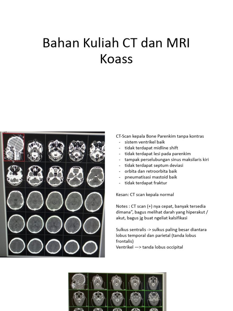 Bahan Kuliah CT MRI Koass | PDF
