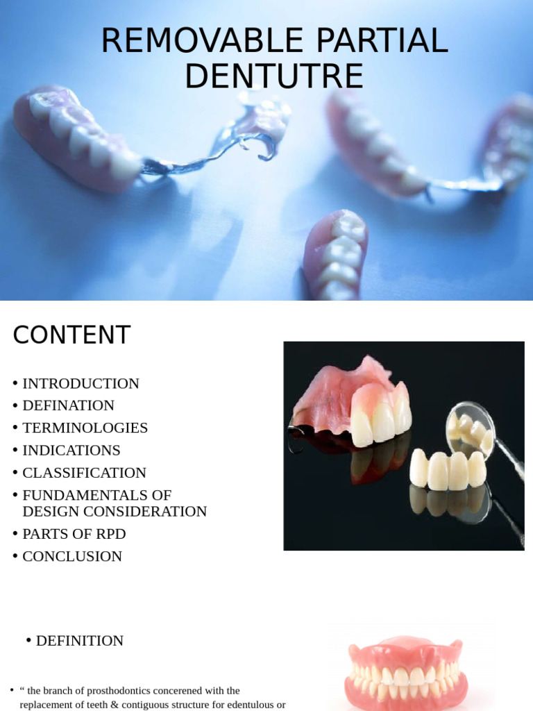 RPD Introduction Scope and Terminologies | PDF | Dentures | Dentistry ...