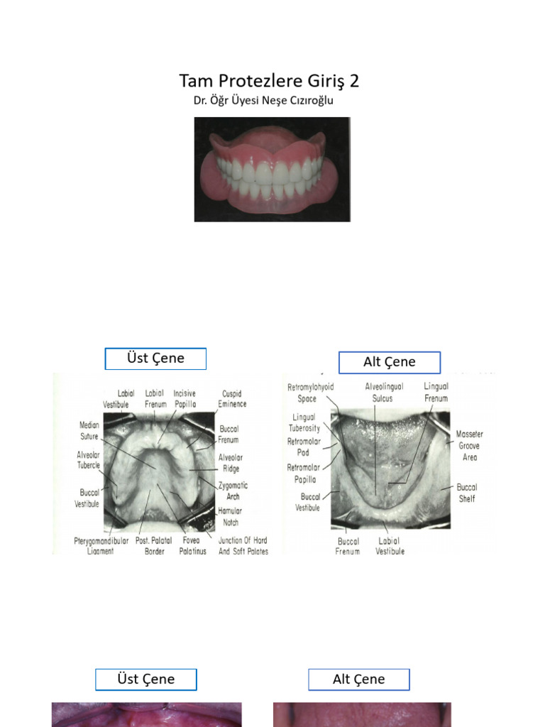 DIS 217 Tam Protezlere Giris 2 | PDF