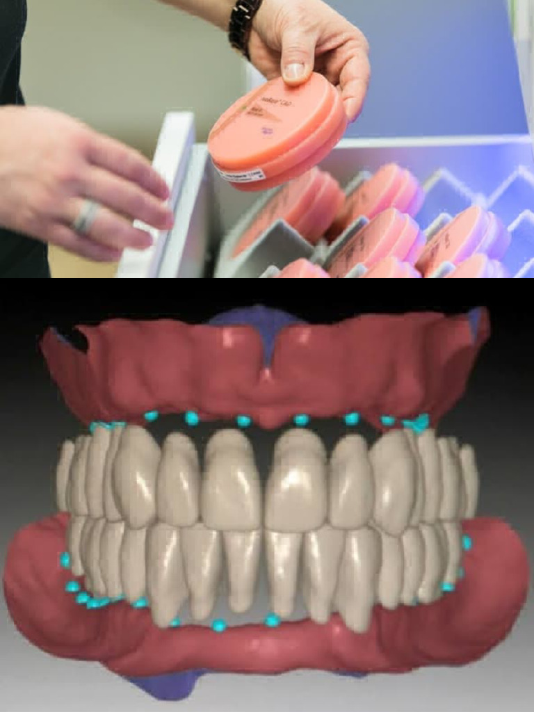 Prostho | PDF