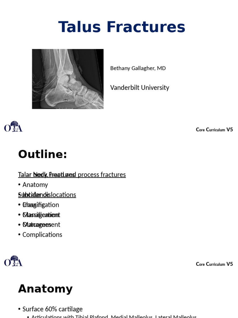Lateral Process Talus Fracture Guide | PDF | Ankle | Skeletal System