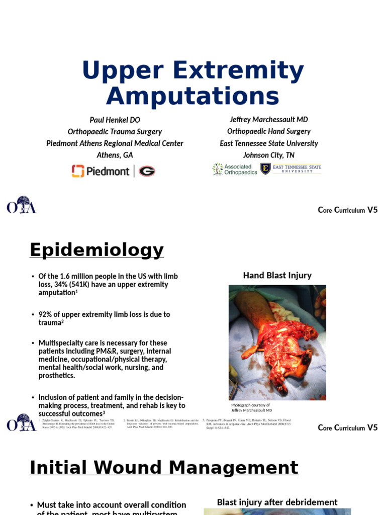 Upper Extremity Amputations: Paul Henkel DO Orthopaedic Trauma Surgery Piedmont Athens Regional ...