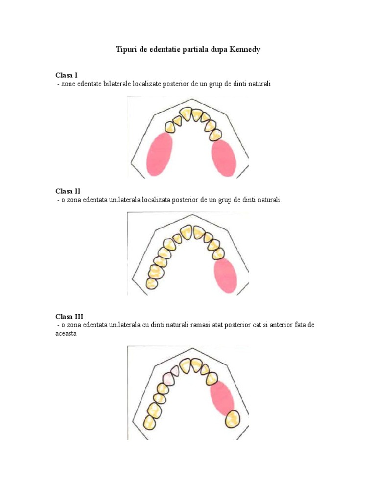 Tipuri de Edentatie | PDF