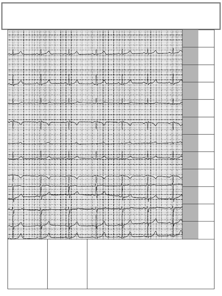 Amanda Vieira - Traçado ECG | PDF | Electrofisiología cardíaca ...
