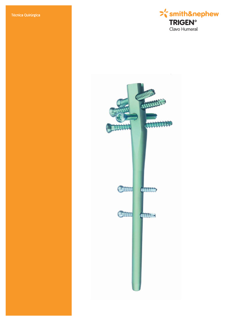Tecnica TQ TRIGEN HUMERAL | PDF | Tornillo