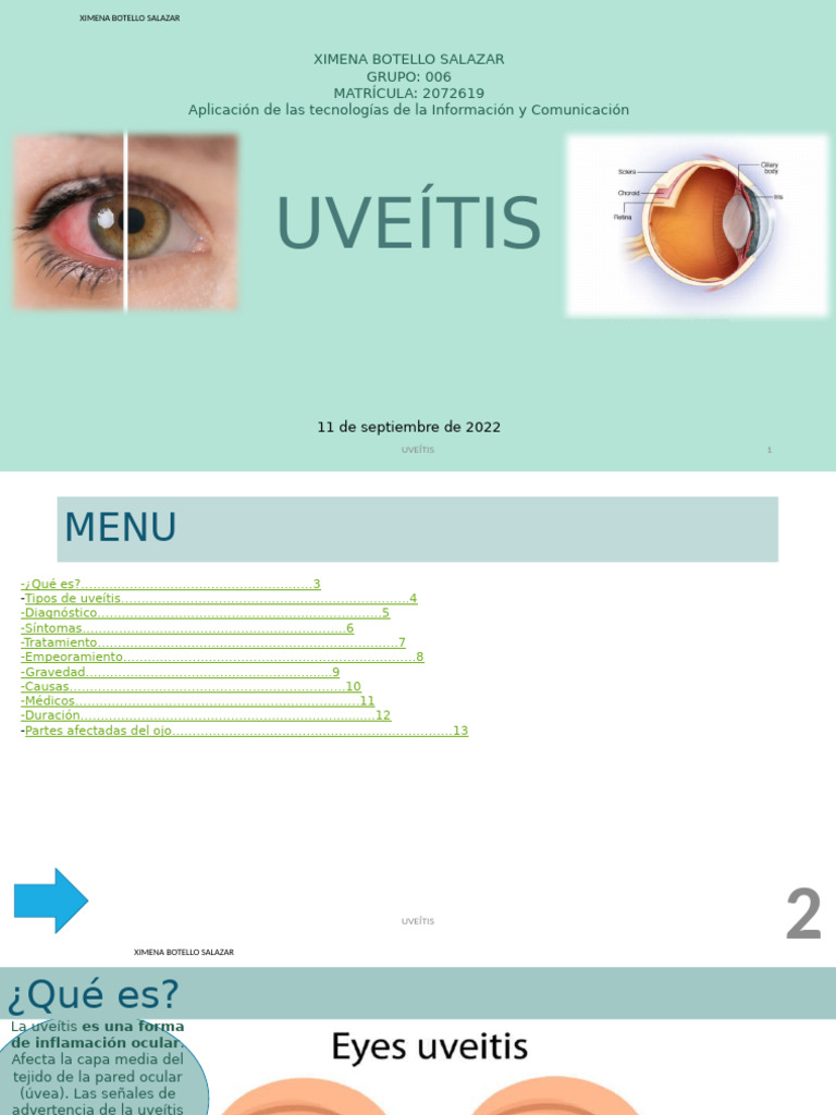 Tratamiento y síntomas de uveítis | PDF | Ojo humano | Percepción visual