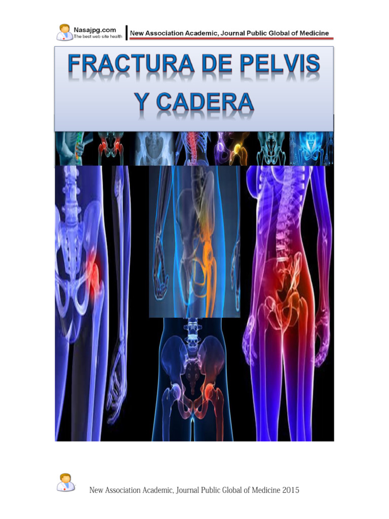 Fractura de Cadera y Pelvis | PDF | Pelvis | Sistema musculoesquelético