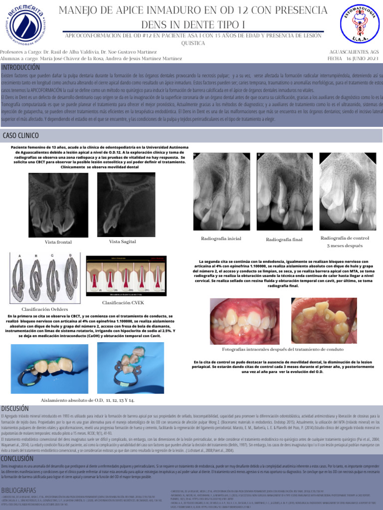 Manejo Endodontico Con Apice Abierto Apicoconformacion Del Od #12 en ...