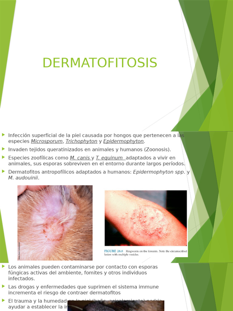 Dermatofitosis: Infección Fúngica en Piel | PDF | Enfermedades y ...