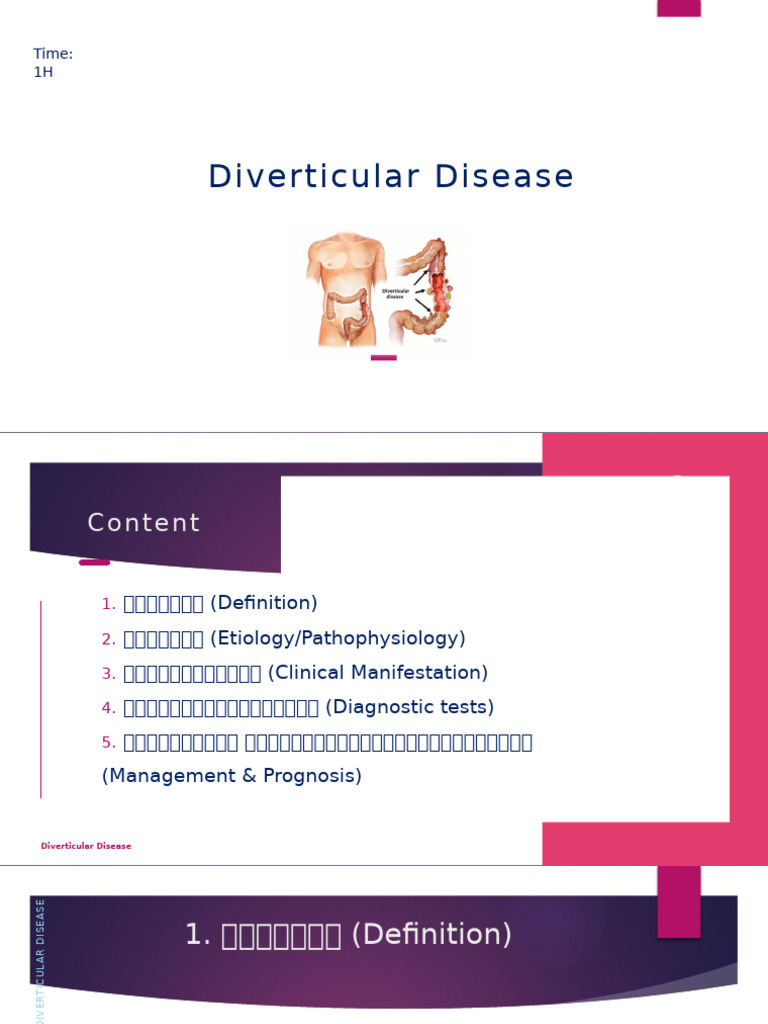 Diverticular Disease | PDF