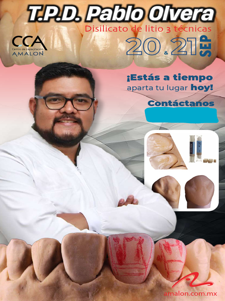 Pabl Olvera 3 Técnicas Litio 2024_ok_compressed | PDF | Anatomia dental | Materiales